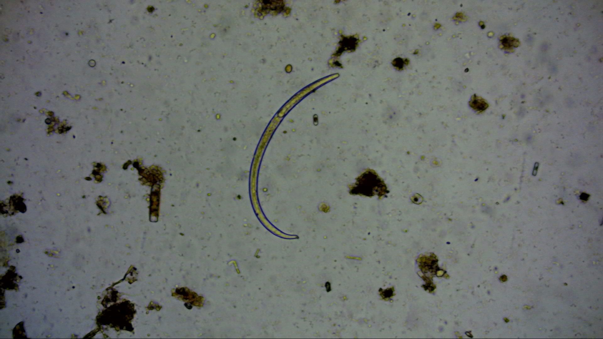 Big Five – 1. Nematodes – Moss Safari