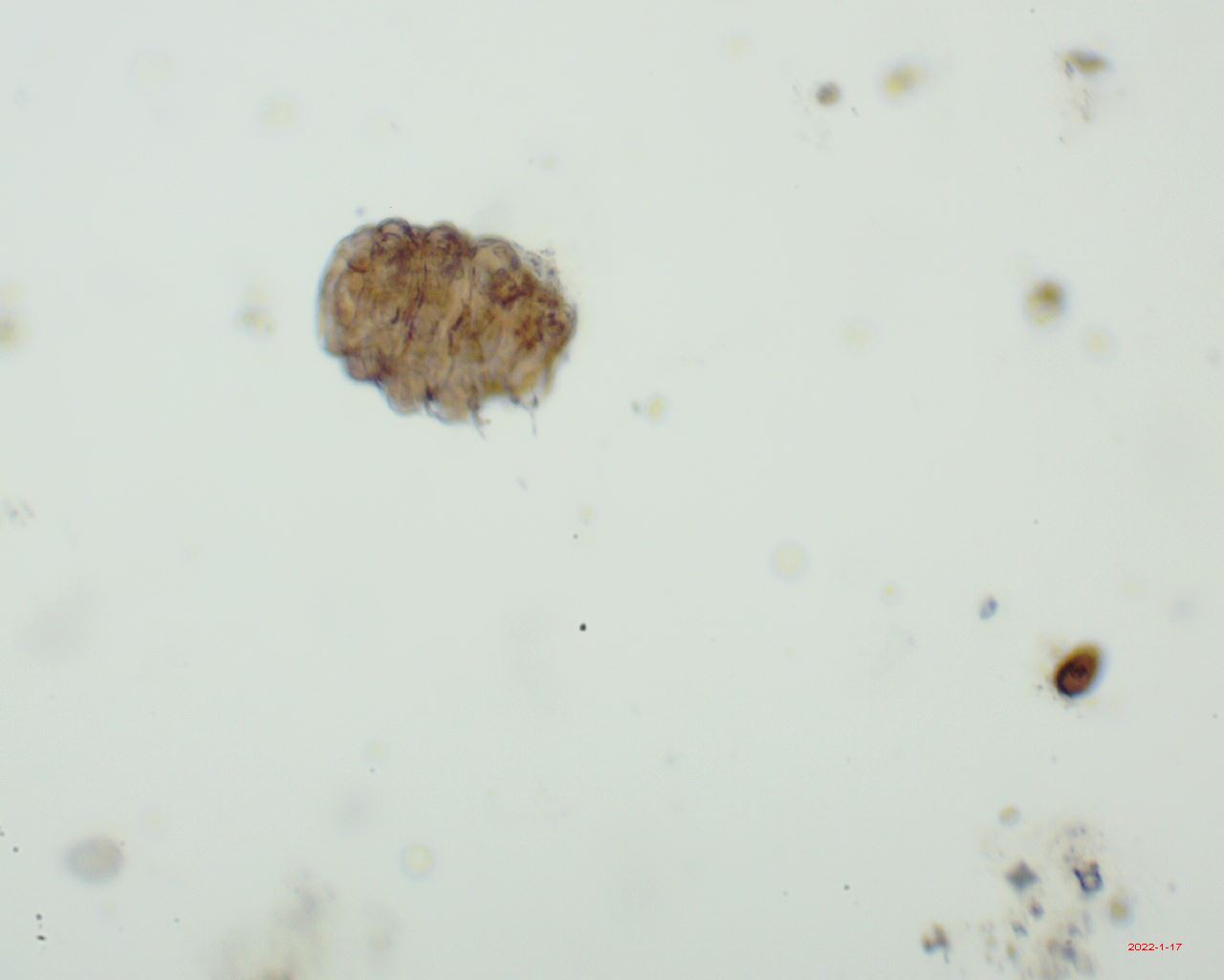 Top Tardigrade Facts for Primary Teachers – Moss Safari